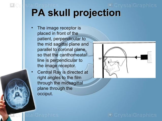 Extraoral radiography | PPT | Dental Health | Diseases and Conditions
