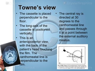 Extraoral radiography | PPT
