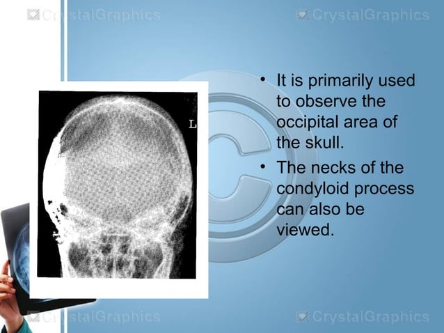 Extraoral radiography | PPT | Dental Health | Diseases and Conditions