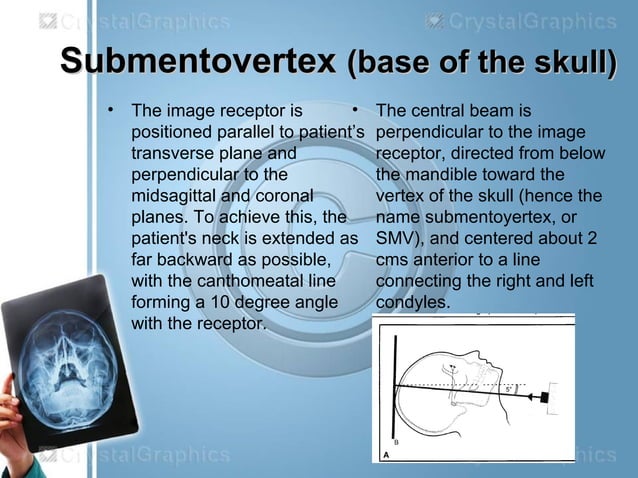 Extraoral radiography | PPT | Dental Health | Diseases and Conditions