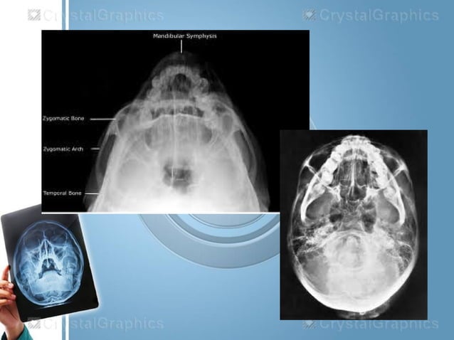 Extraoral radiography | PPT | Dental Health | Diseases and Conditions