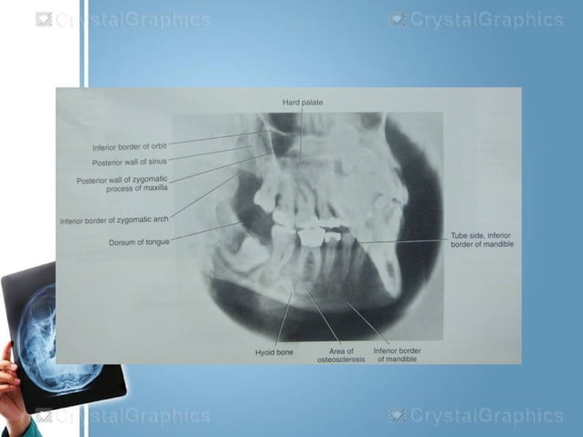 Extraoral radiography | PPT | Dental Health | Diseases and Conditions