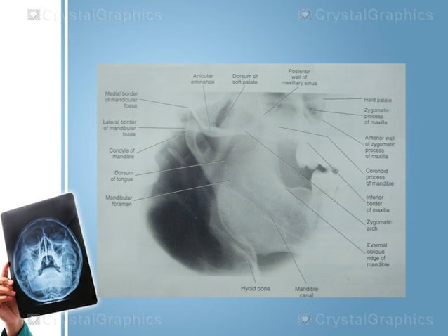 Extraoral radiography | PPT | Dental Health | Diseases and Conditions