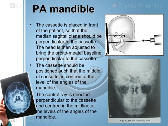 Extraoral radiography | PPT | Dental Health | Diseases and Conditions