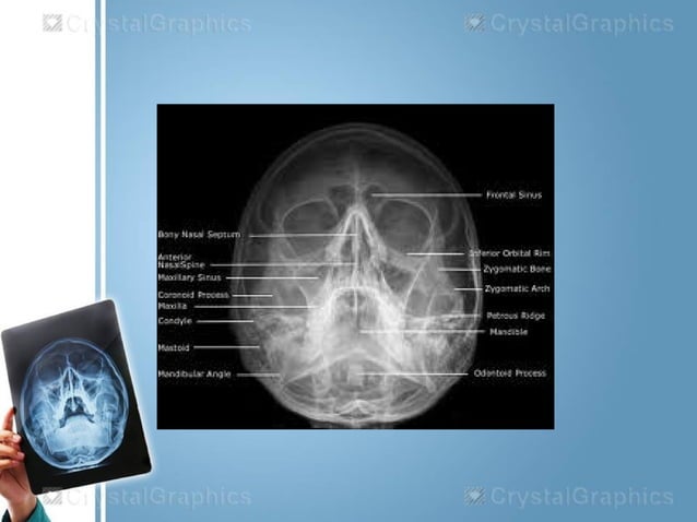 Extraoral radiography | PPT | Dental Health | Diseases and Conditions