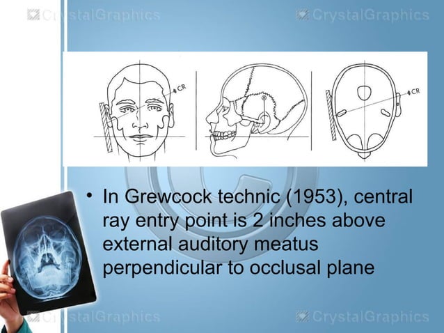 Extraoral radiography | PPT | Dental Health | Diseases and Conditions