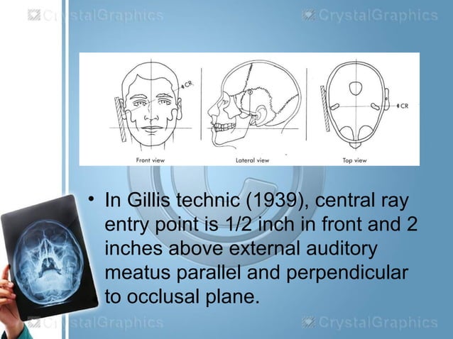 Extraoral radiography | PPT | Dental Health | Diseases and Conditions