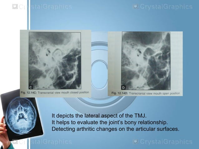 Extraoral radiography | PPT | Dental Health | Diseases and Conditions