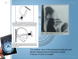 Extraoral radiography | PPT
