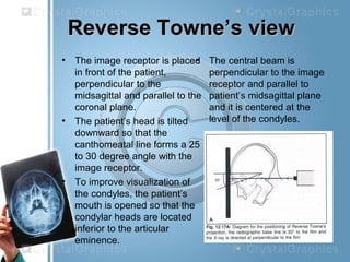 Extraoral radiography | PPT
