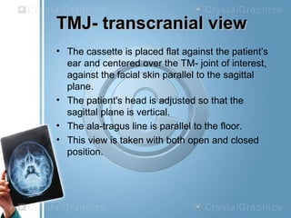 Extraoral radiography | PPT
