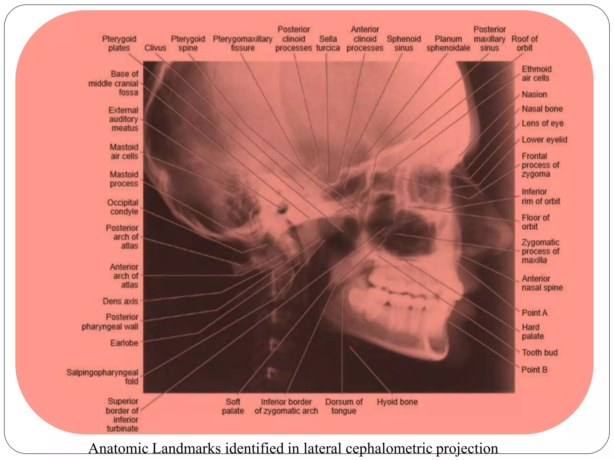 Extra-oral Radiographic Techniques | PPTX