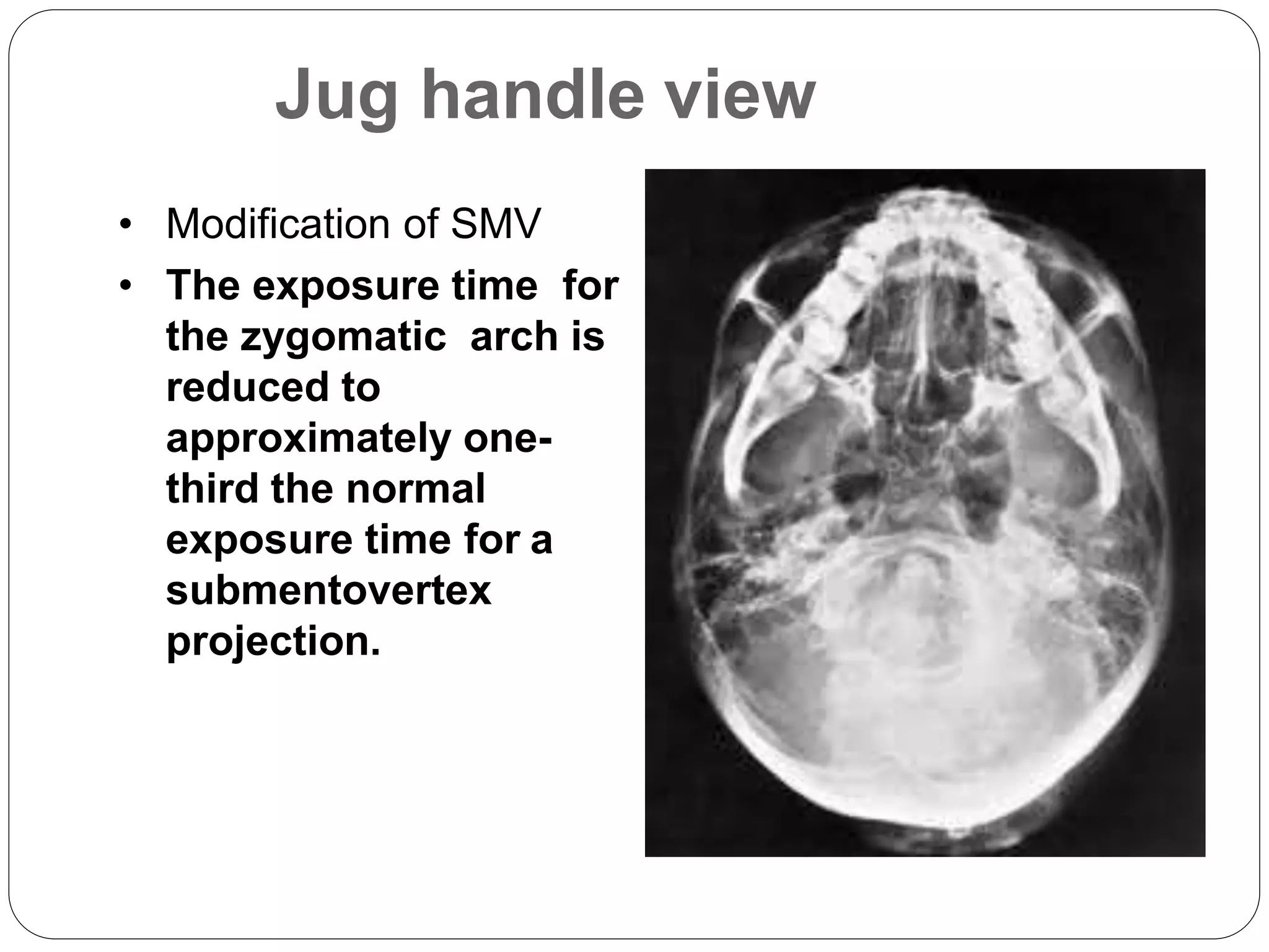 Extra-oral Radiographic Techniques | PPTX
