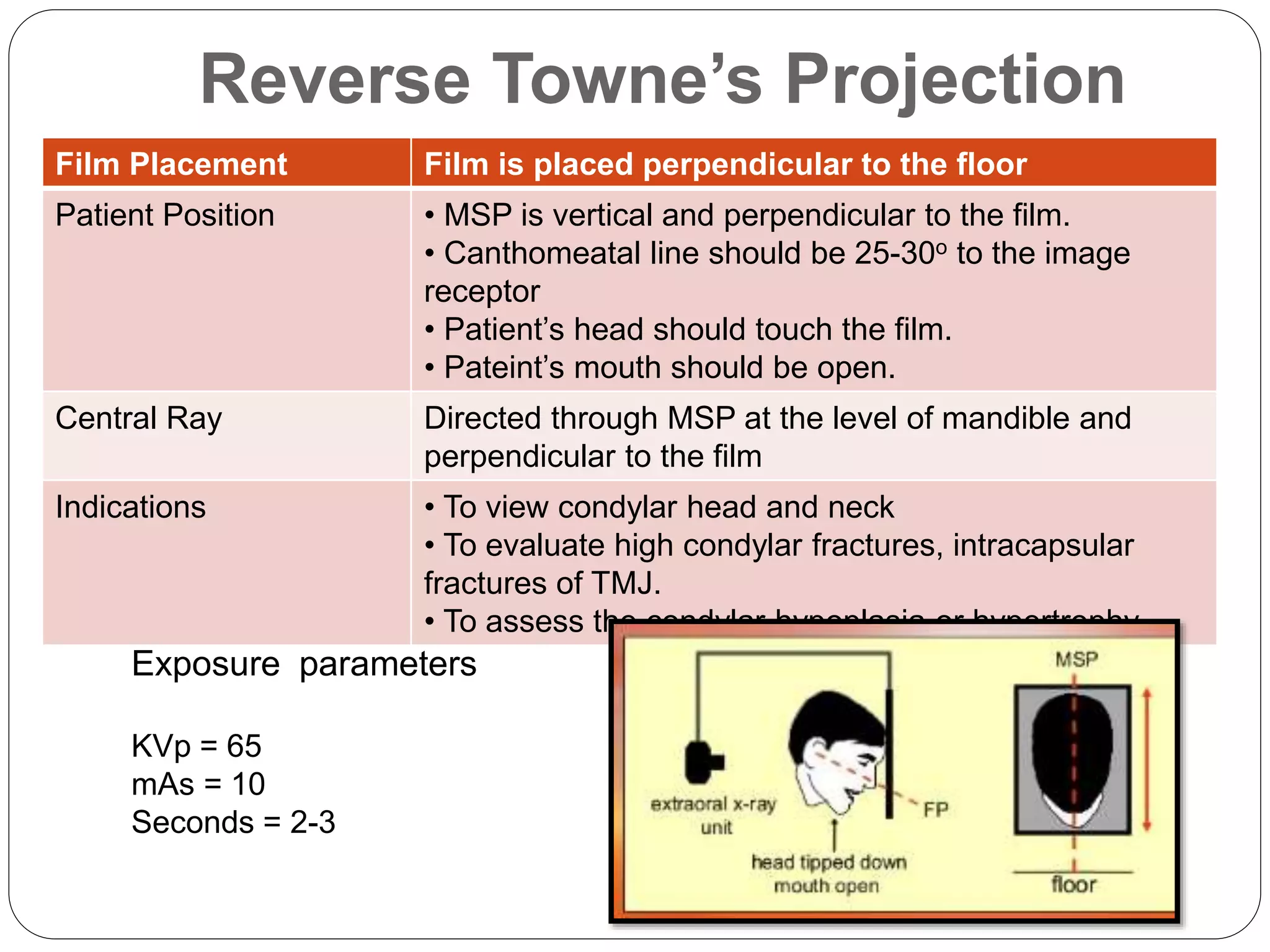 Extra-oral Radiographic Techniques | PPTX