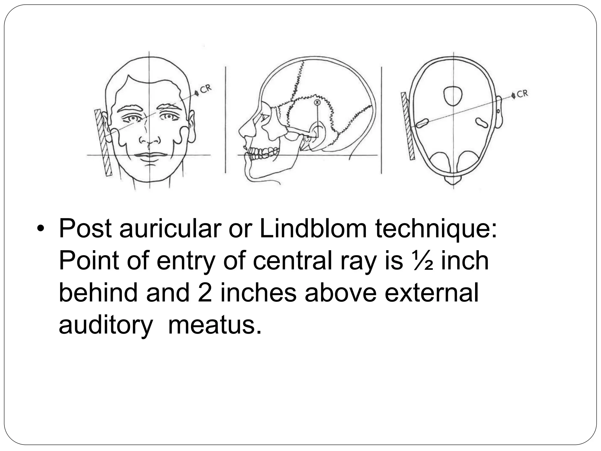 Extra-oral Radiographic Techniques | PPTX