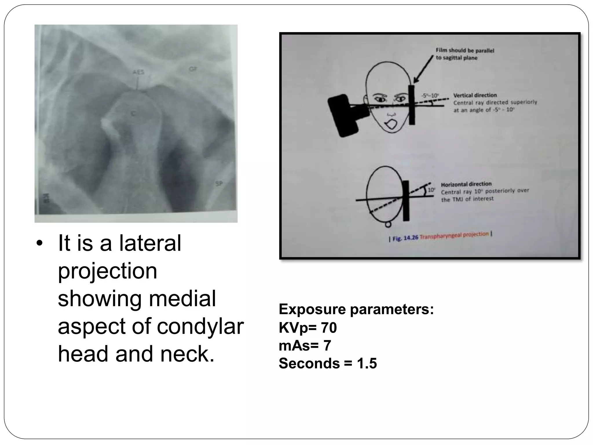 Extra-oral Radiographic Techniques | PPTX