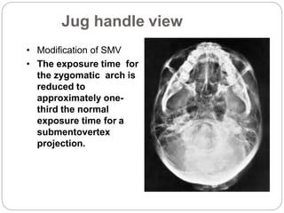 Extra-oral Radiographic Techniques | PPTX