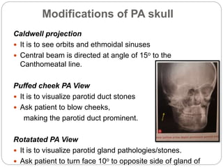 Extra-oral Radiographic Techniques | PPTX