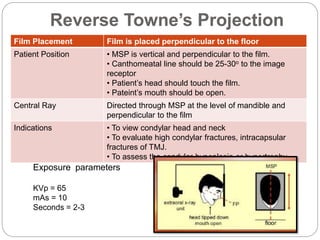 Extra-oral Radiographic Techniques | PPTX