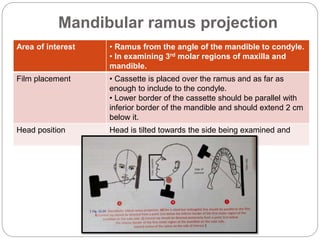 Extra-oral Radiographic Techniques | PPTX