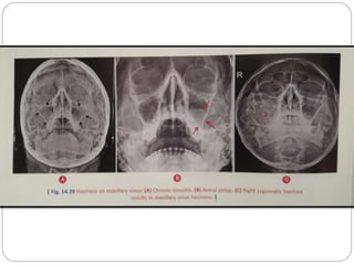 Extra-oral Radiographic Techniques | PPTX