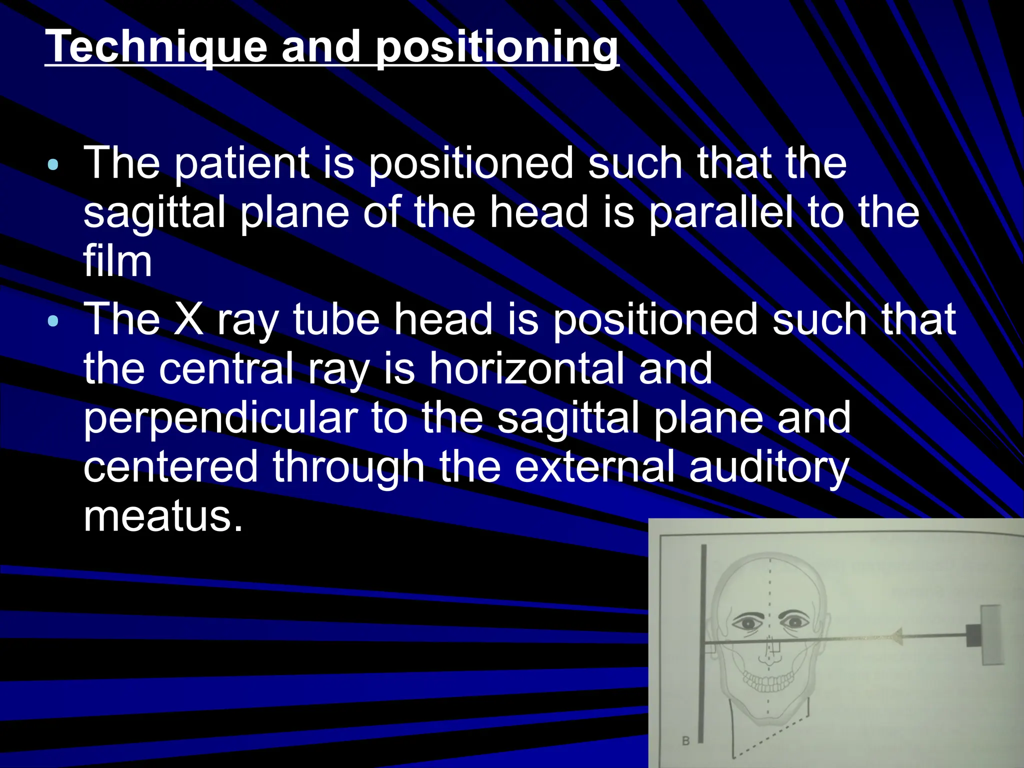 Dental extra-oral radiography ppt final.pptx