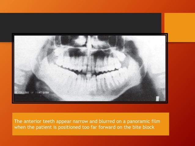 EXTRA ORAL RADIOGRAPHY | PPTX
