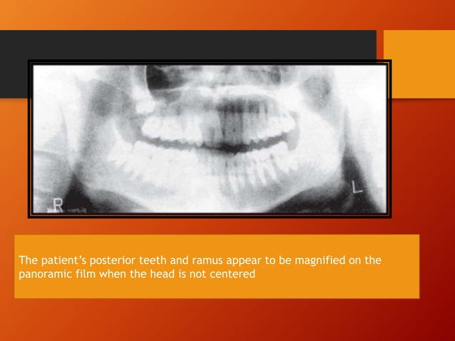 EXTRA ORAL RADIOGRAPHY | PPTX