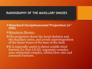EXTRA ORAL RADIOGRAPHY | PPTX