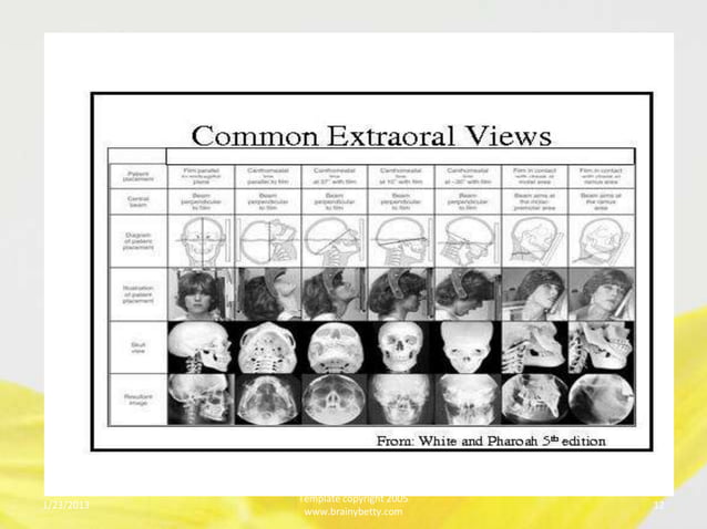 Extra oral techniques | PPTX | Dental Health | Diseases and Conditions