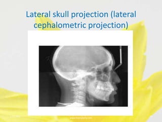 Extra oral techniques | PPTX