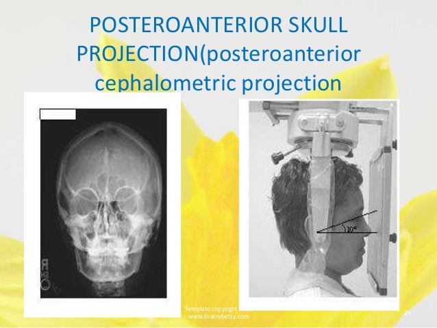 Extra oral techniques