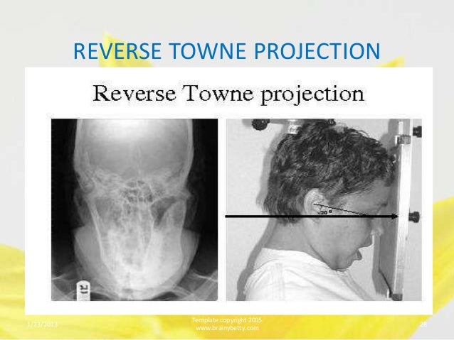 Extra oral techniques