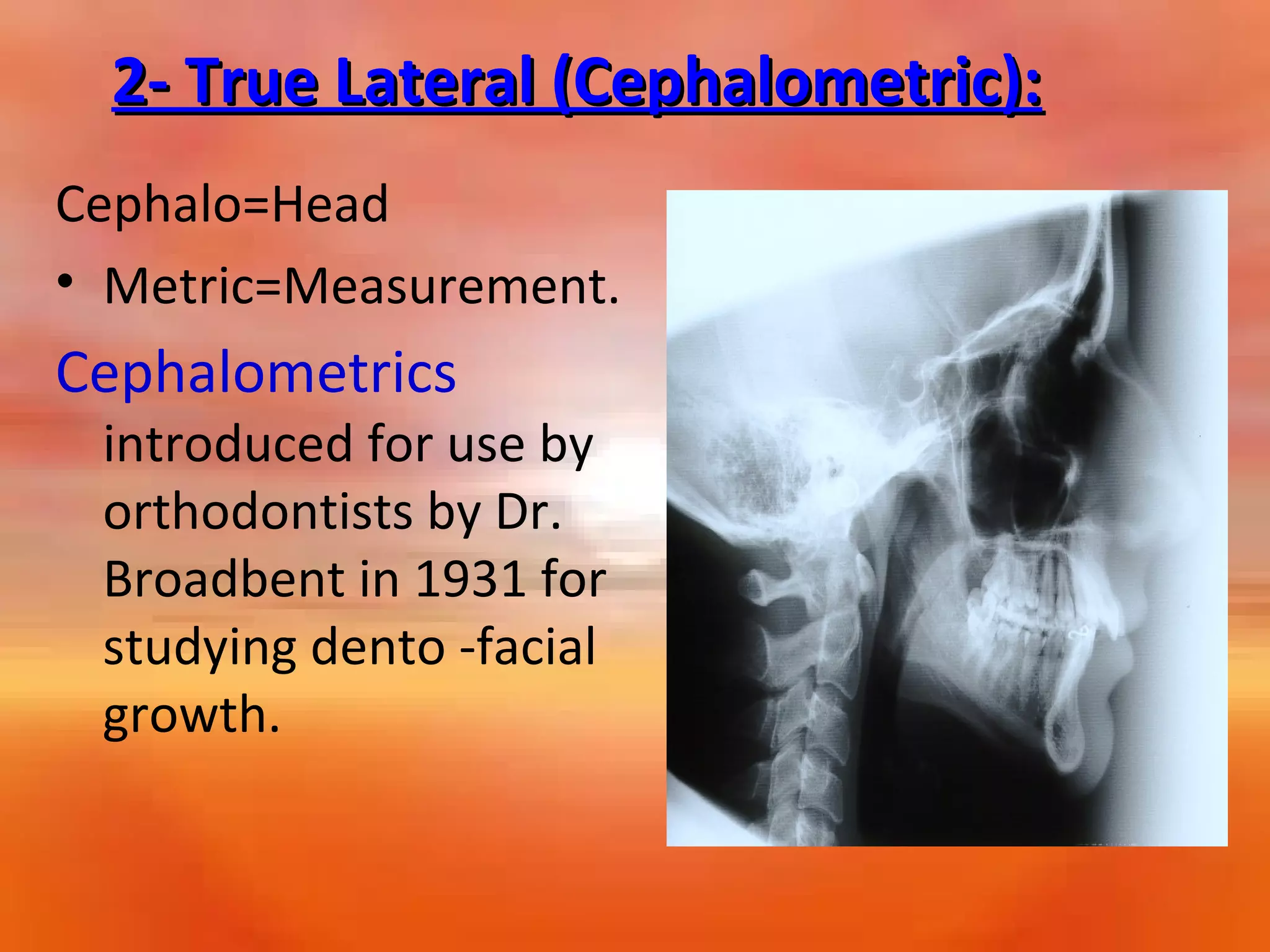 Extra-oral Radiology Techniques I | PPT