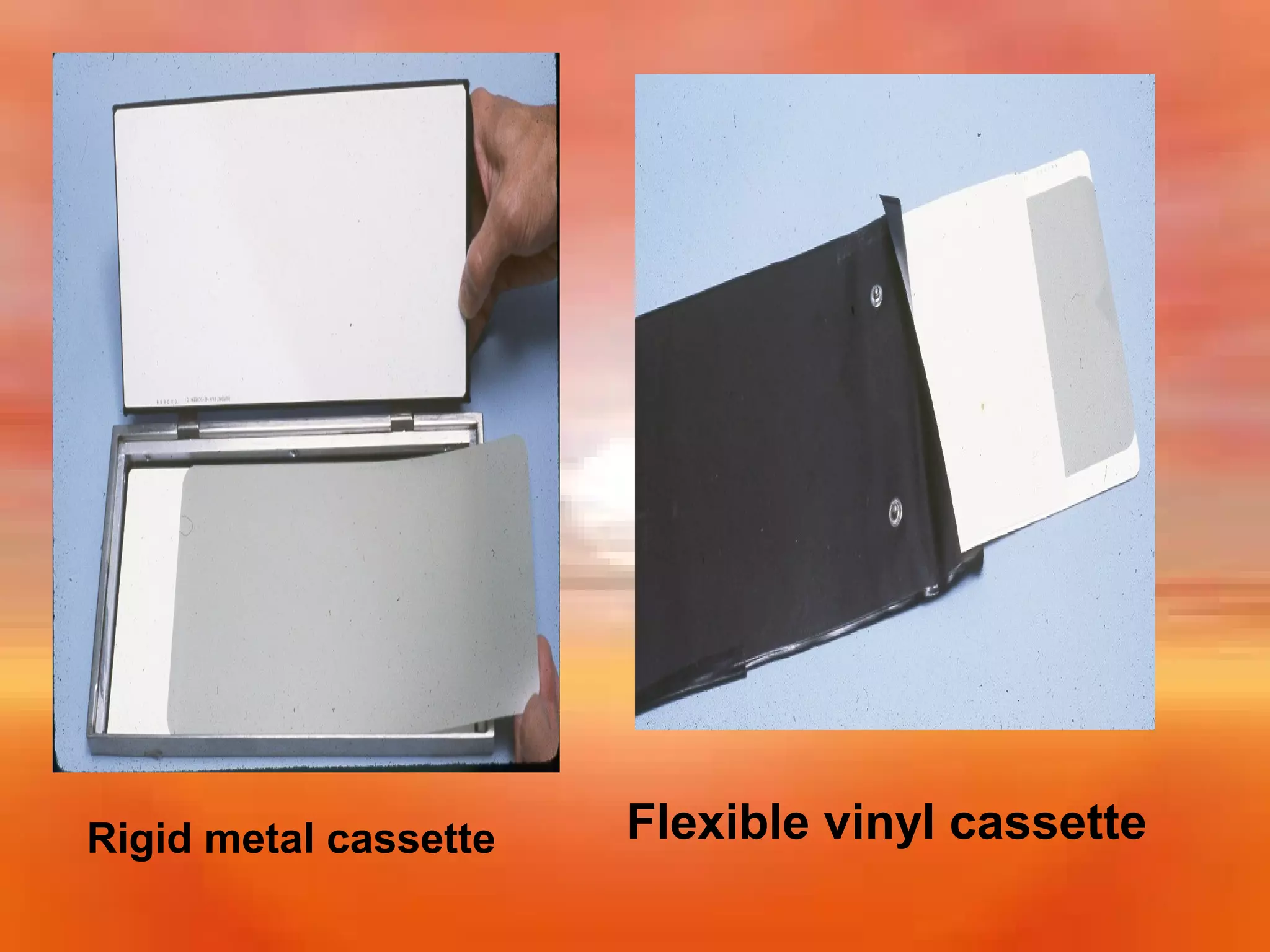 Extra-oral Radiology Techniques I | PPT