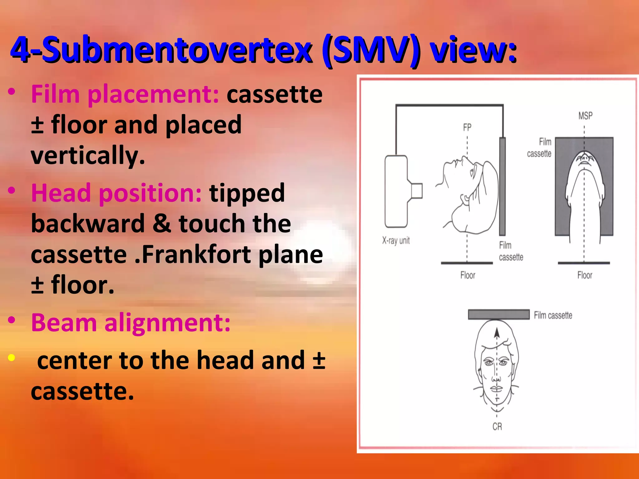 Extra-oral Radiology Techniques I | PPT