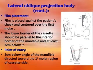 Extra Oral Radiographic Techniques I | PPT