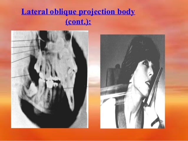 Extra Oral Radiographic Techniques I