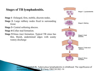 Extra ptb lymphnode tb | PPTX | Lung and Respiratory Health | Diseases ...