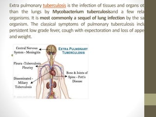 Extrapulmunary tb and chronic pancreatitis.ppt