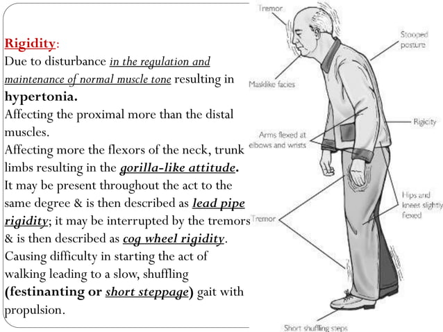 Extrapyramidal disorders | PDF | Physical Therapy | Wellness