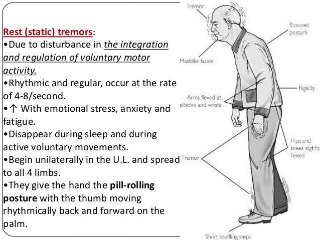 Extrapyramidal disorders
