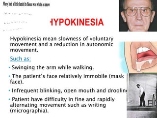 Extrapyramidal disorders (Parkinson disease) | PPTX | Brain and Nervous ...