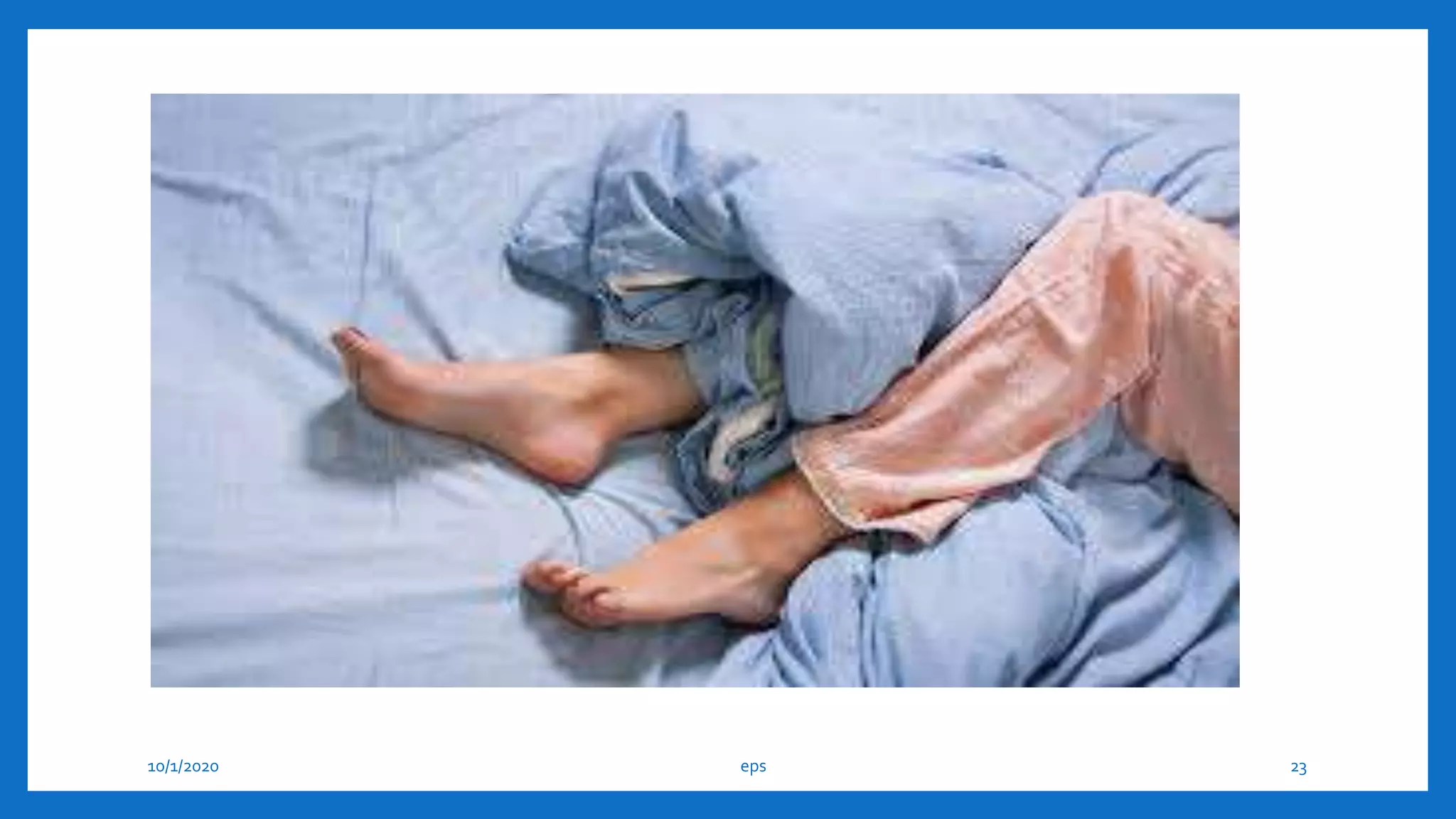 Extra pyramidal side effects | PPTX