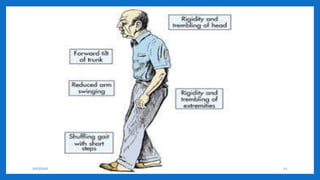 Extra pyramidal side effects | PPTX