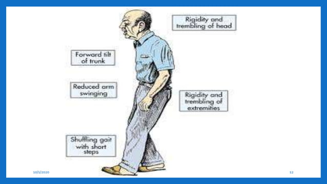 Extra pyramidal side effects | PPTX
