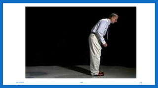 Extra pyramidal side effects | PPTX