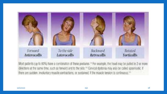 Extra pyramidal side effects | PPTX