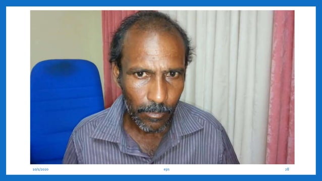 Extra pyramidal side effects | PPTX