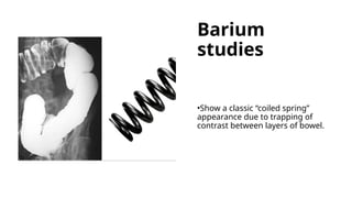 Extras for intussusception with barium .pptx